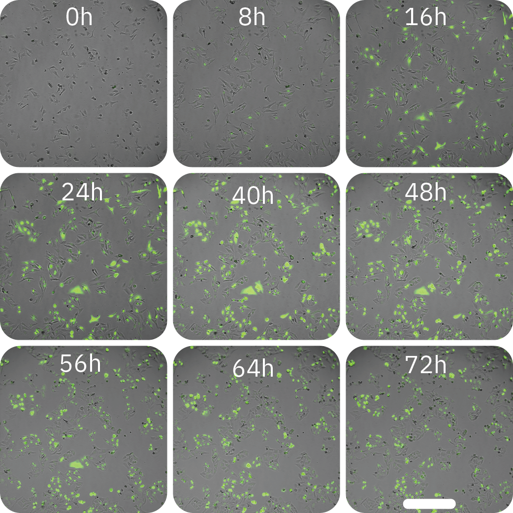 Analysis of BacMam Transduced HeLa Cells with High-Throughput Live-Cell Imaging | Axion Biosystems